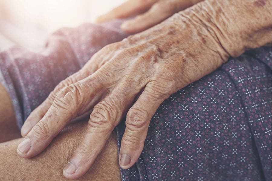 Age spots on the skin: causes and how to get rid of them – Get Full Care